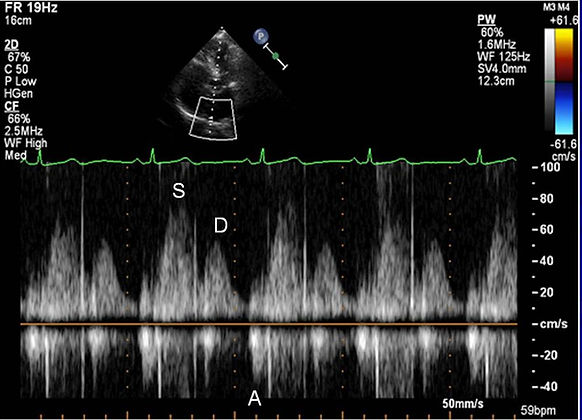 Apicals | Echocardiographer.org